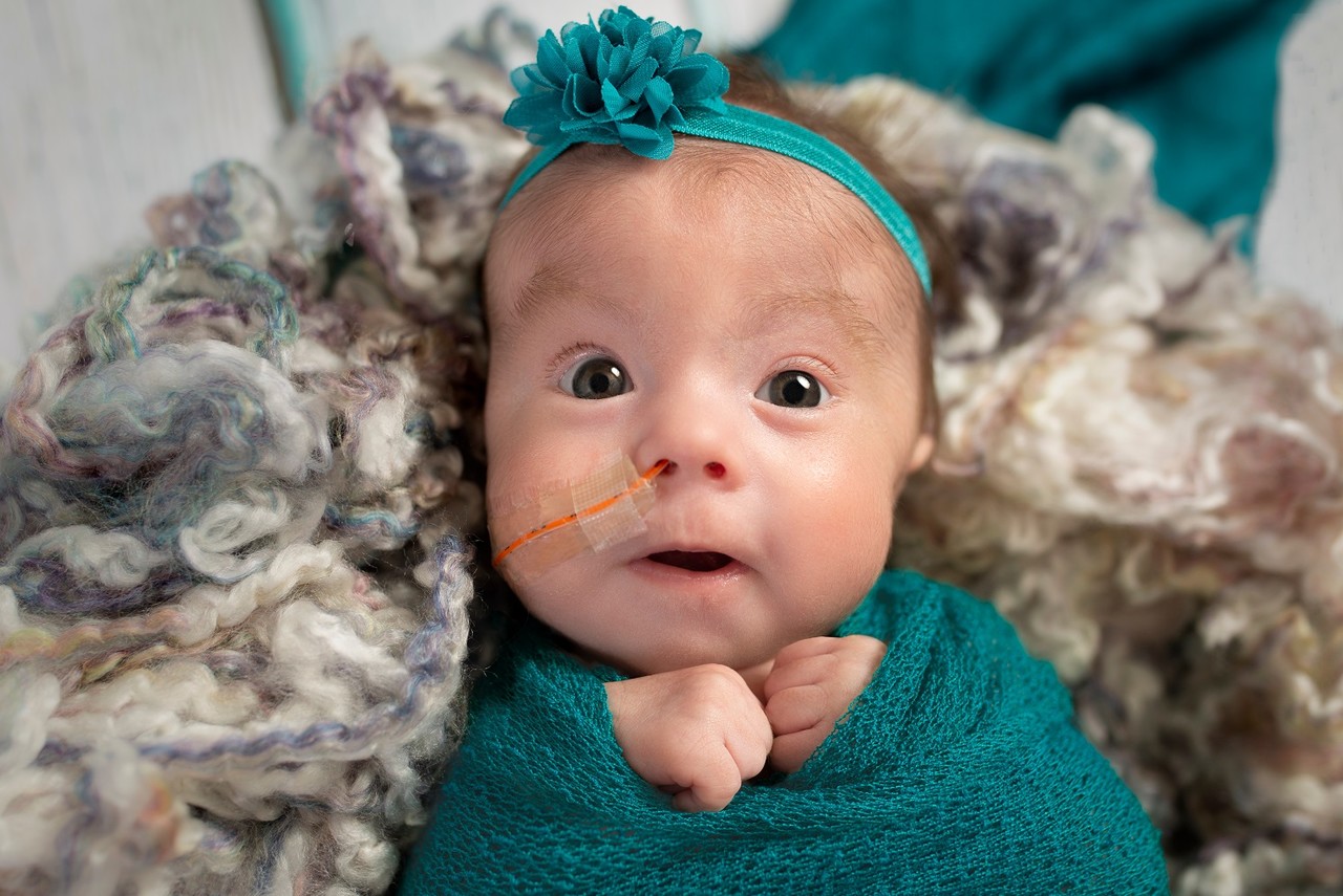 Edwardsov syndróm: Ako sa prejavuje a čo zvyšuje riziko ochorenia ...