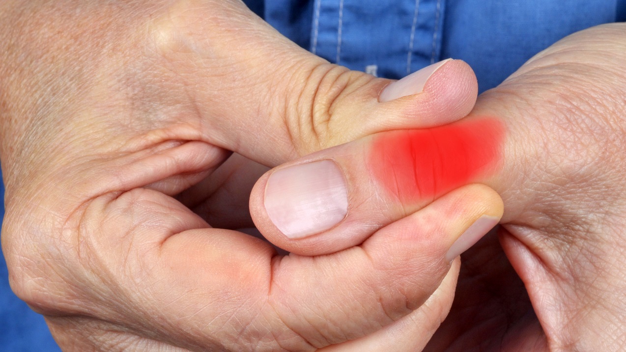 Pociťuješ bolesť palca na ruke? Tu je 10 možných príčin - KAMzaKRASOU.sk